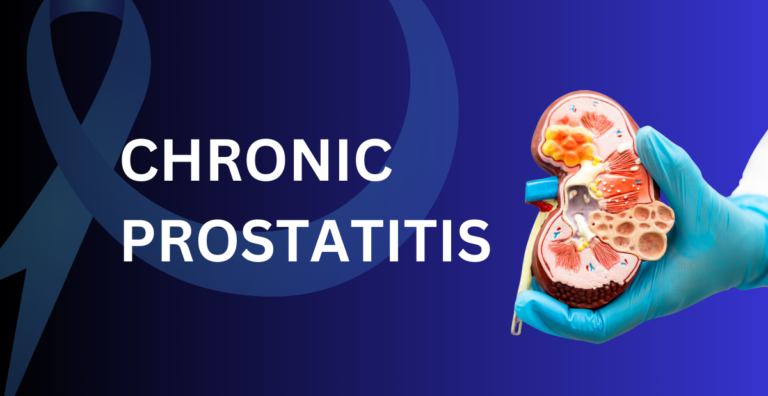 Chronic prostatitis: Causes, symptoms, diagnosis, and treatment